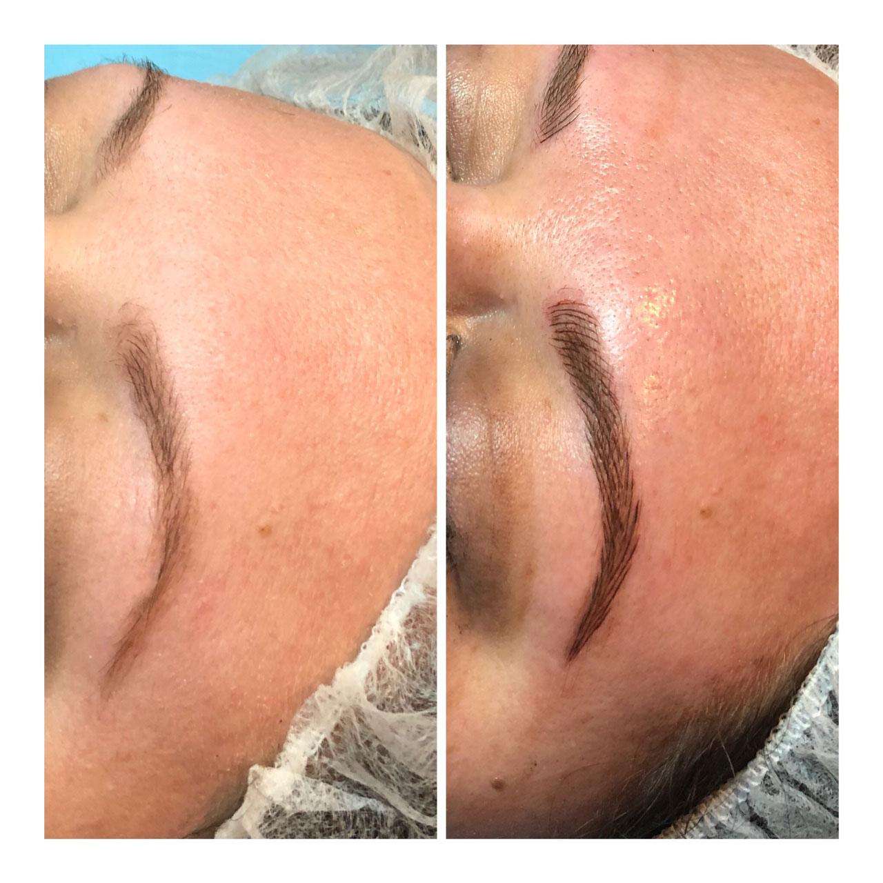 Achieve Flawless Brows with Microblading